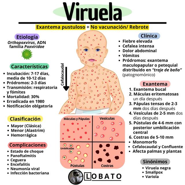 Viruela mayor (Clásica)🩺| Exantemas Infectología | Clínica, Etiología | Lobato MD | uDocz