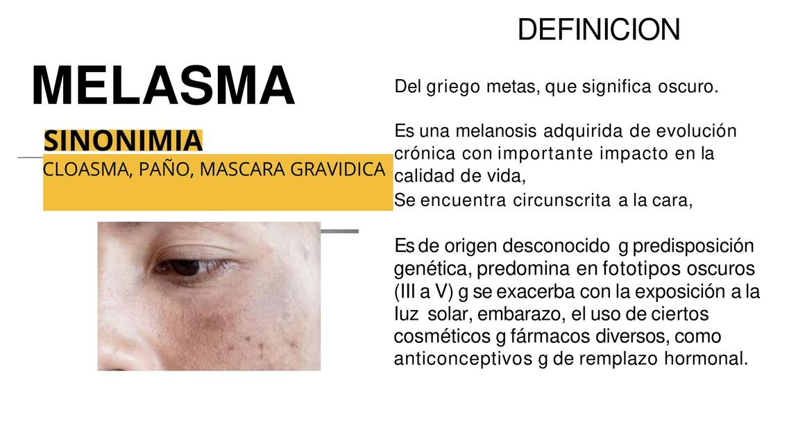 Melasma | ZOE MEDINA | uDocz