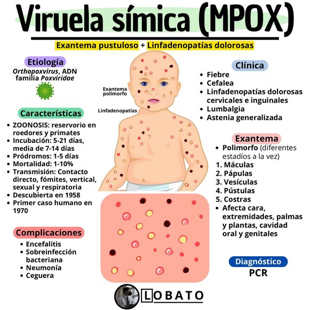 Viruela símica MPOX 🩺| Exantemas Infectología | Clínica, Etiología ...