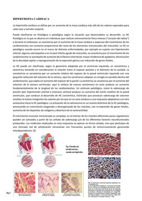 Hipertrofia cardiaca | BIA | uDocz
