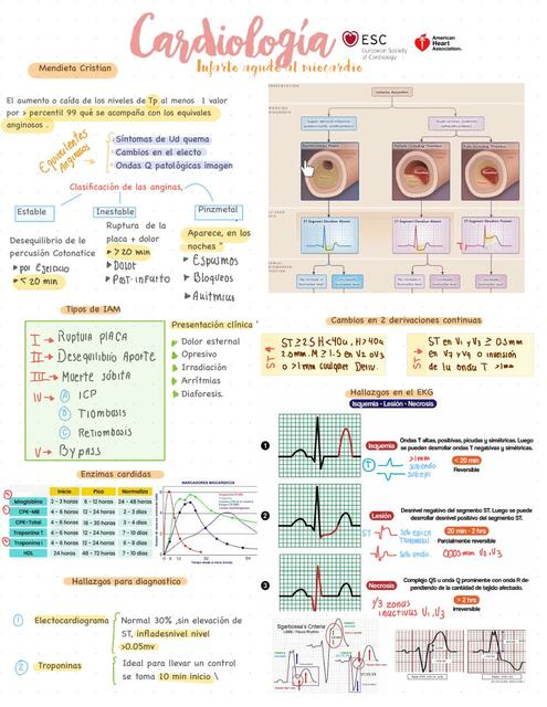 Infarto agudo al miocardio | Mendieta Cristian | uDocz