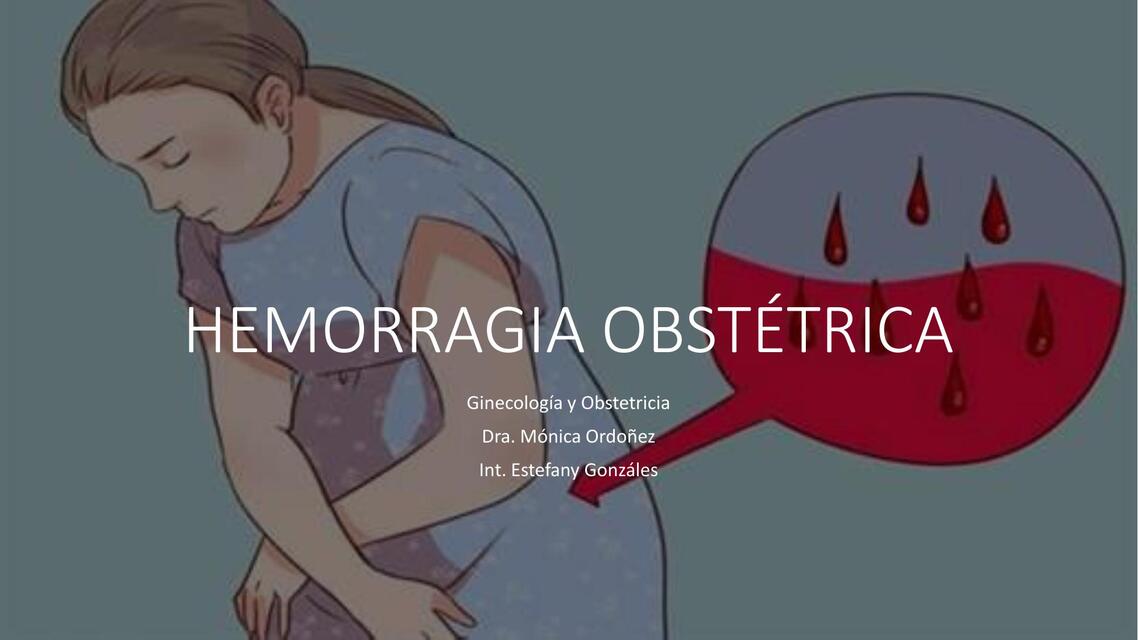Hemorragia obstétrica | Estefany Gonzáles | uDocz