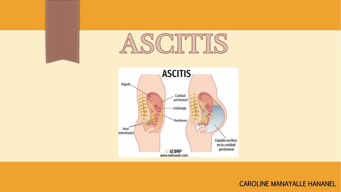 ASCITIS | CarolineCecilia Manayalle | uDocz