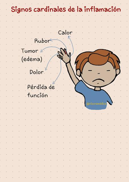 Signos cardinales de la inflamación | Mizonamédica | uDocz