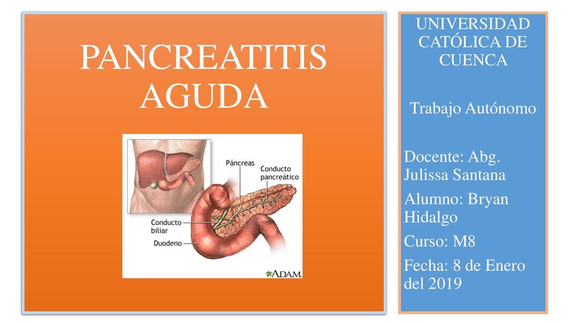 PANCREATITIS AGUDA | Bryan Hidalgo | uDocz
