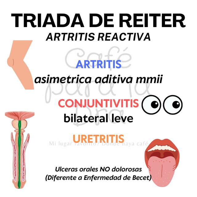 Triada de reiter | Dra. Baltodano | uDocz