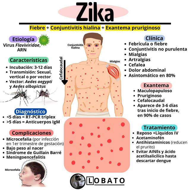Zika 🦟🩺| Clínica, Diagnóstico, Tratamiento, Exantema | Arbovirus | Lobato MD | uDocz