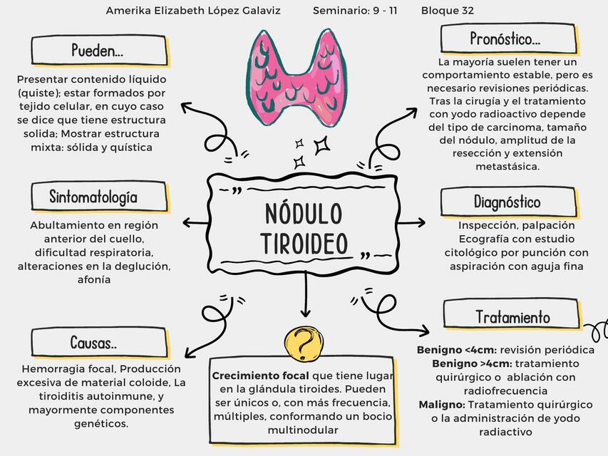 Nódulo tiroideo | Amerika Elizabeth Lopez Galaviz | uDocz