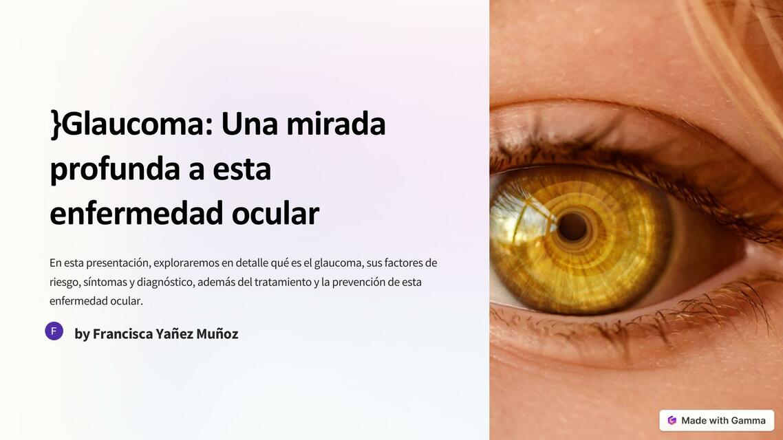 Glaucoma Una mirada profunda a esta enfermedad ocular | Francisca Yañez Muñoz | uDocz