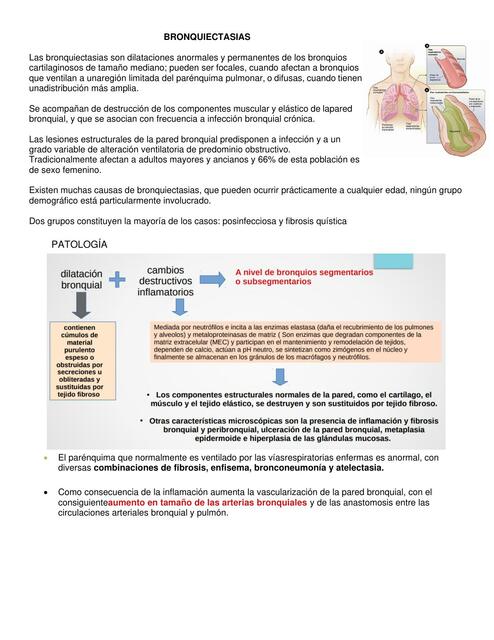 Bronquiectasias | Mitzii Caballero | uDocz