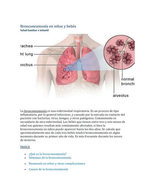 Flashcards de Bronconeumonía en niños y bebés | Por Aura Ester Peréz ...