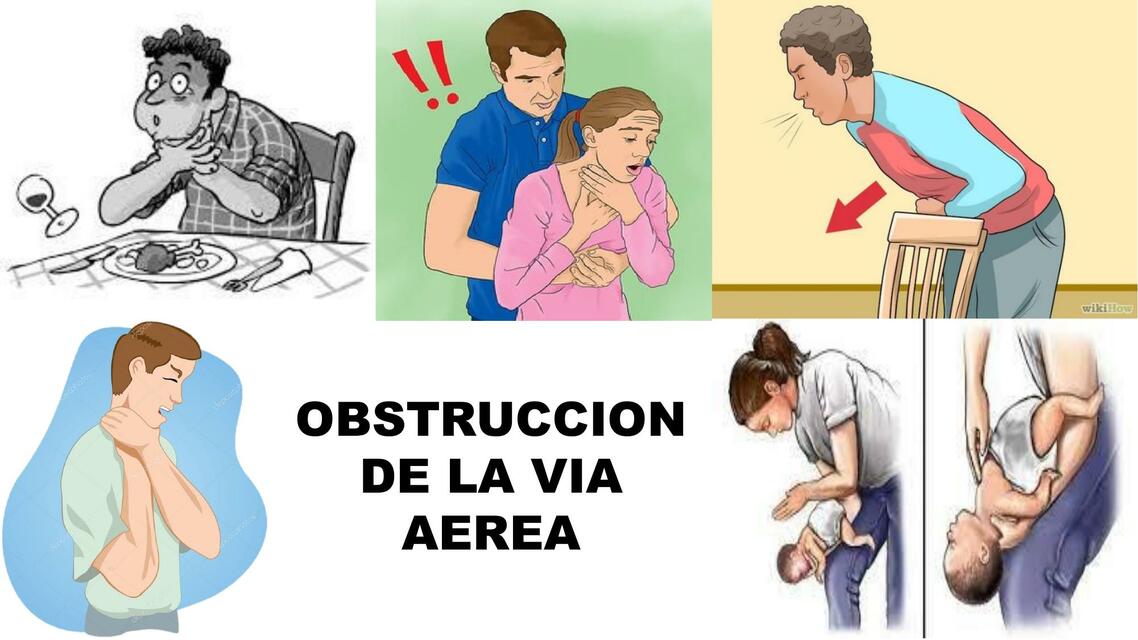 Obstrucción de la vía aérea | Denisse Victoria Vallejos Olano | uDocz Obstrucción de la vía aérea | Denisse Victoria Vallejos Olano | uDocz