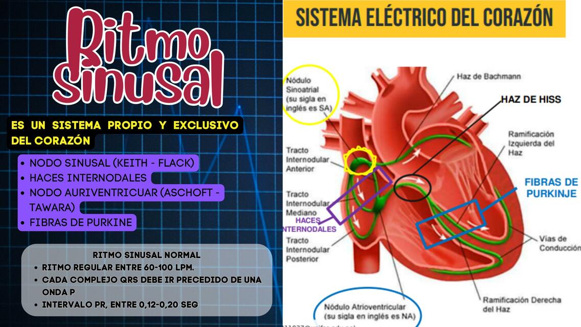Ritmos sinusal | MARLEY ROSALIND ELIZAMA VERA BARRETO | uDocz