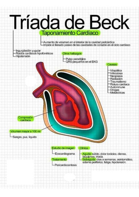 Tríada de Beck | fraii | uDocz