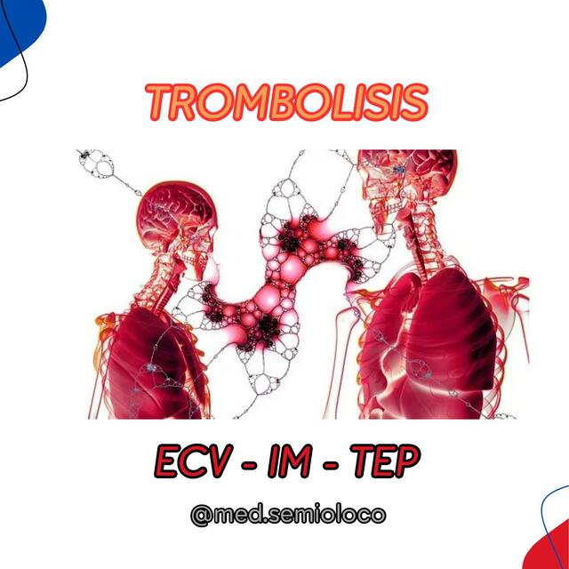 Trombólisis en urgencias | Víctor Rodriguez Botero - @med.semioloco | uDocz