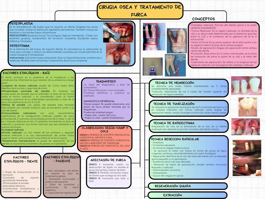 Cirugía Ósea y Tratamiento de Furca | José Janto | uDocz