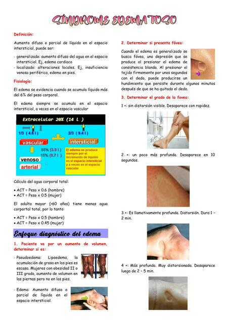 Resúmenes de Síndrome edematoso | Descarga apuntes de Síndrome edematoso