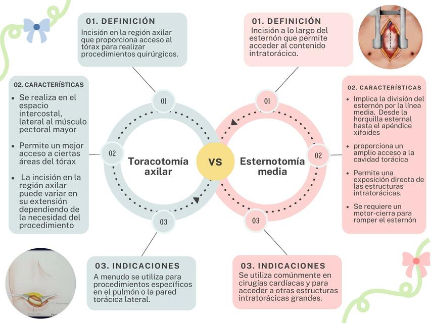 Toracotomía axilar y esternotomía media | Mar | uDocz