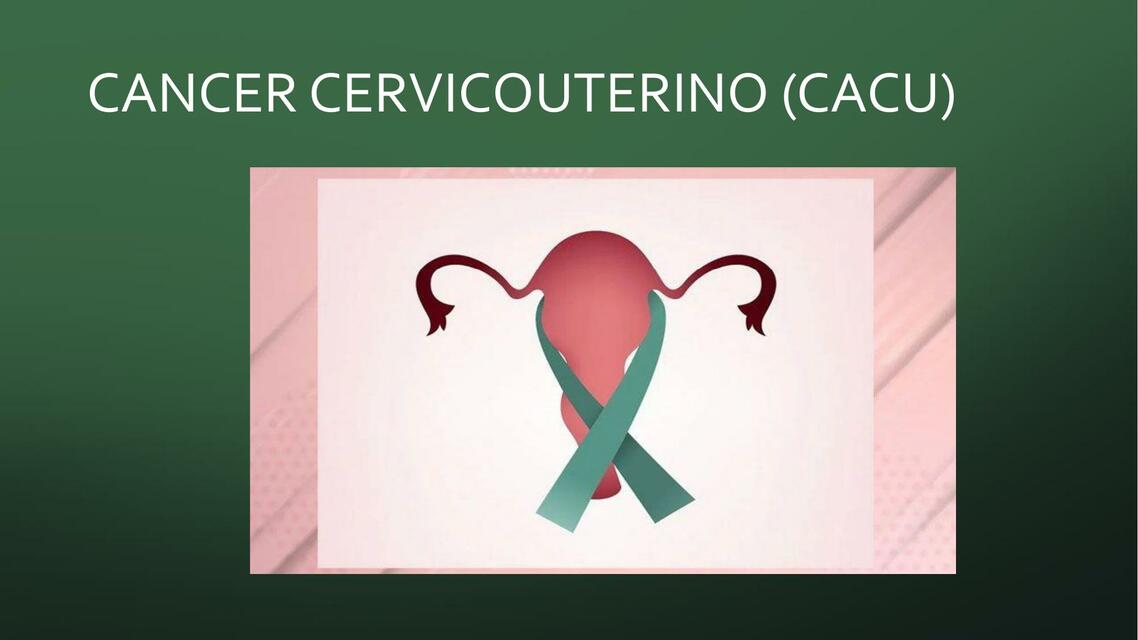 Cancer cervicouterino | uDocz