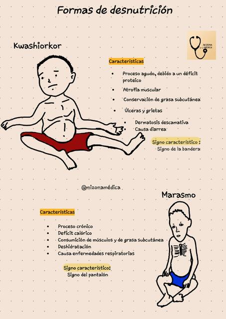 Formas De Desnutrición Mizonamédica Udocz