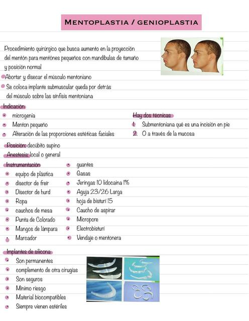 Mentoplastia | laurav98o | uDocz