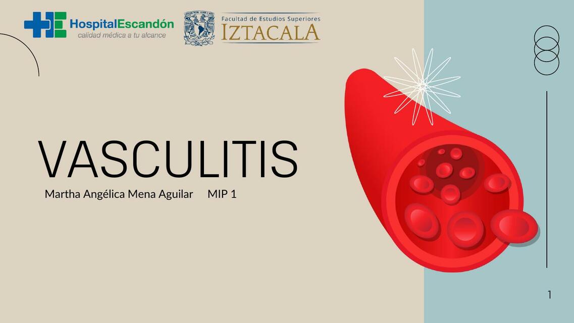 Vasculitis | Angélica Mena | uDocz