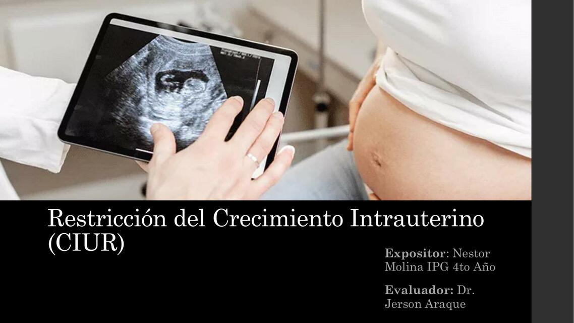 Flashcards de Retardo Del Crecimiento Intrauterino o CIUR | Por ...