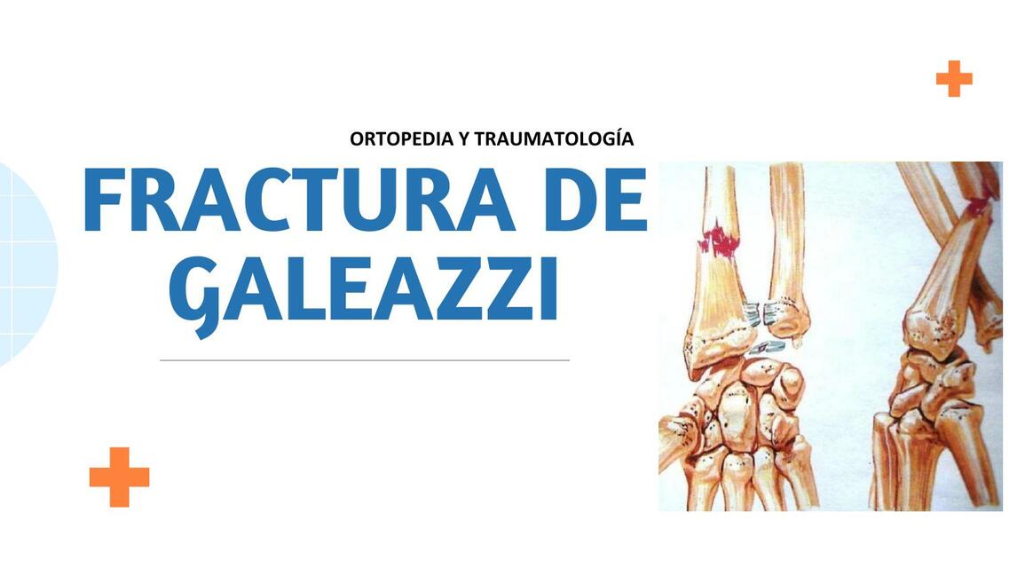 Fractura de galeazzi | Mis apuntes de Medicina | uDocz