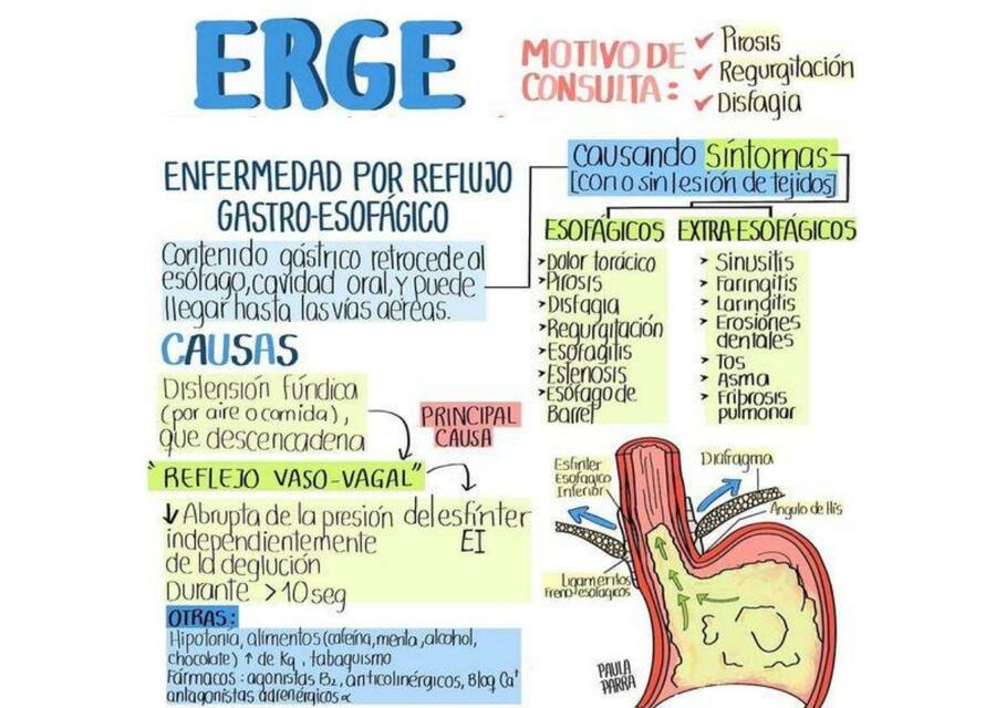 ERGE (Enfermedad por Reflujo Gastro-Esofágico) | fraii | uDocz