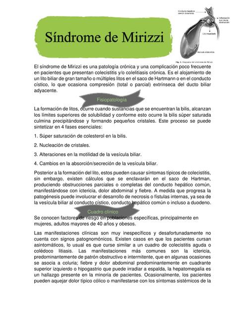 Síndrome de Mirizzi | uDocz