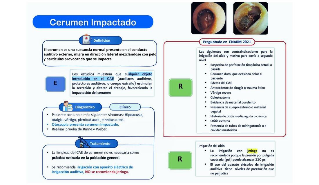 Cerumen Impactado | uDocz