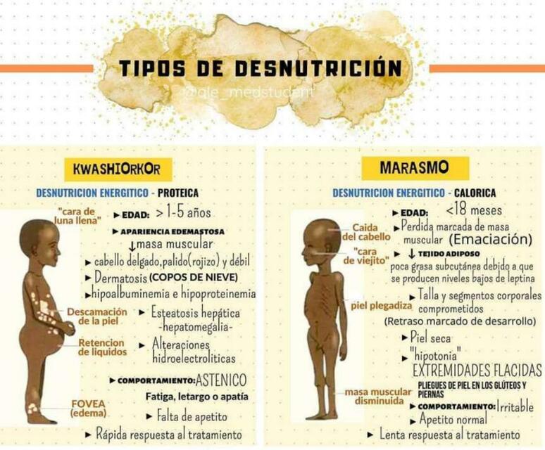 Tipos de Desnutricion | YUDOC.ORG | uDocz