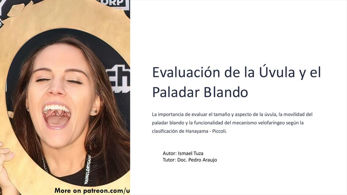 Evaluación de la Úvula y el Paladar Blando | Ismael Tuza | uDocz