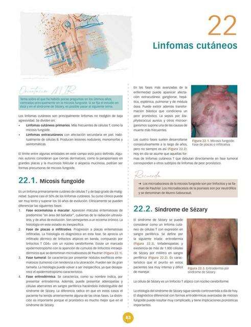 Linfomas cutáneos | Full ciencia | uDocz
