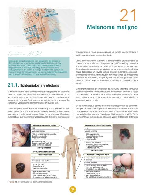 Melanoma maligno | Full ciencia | uDocz