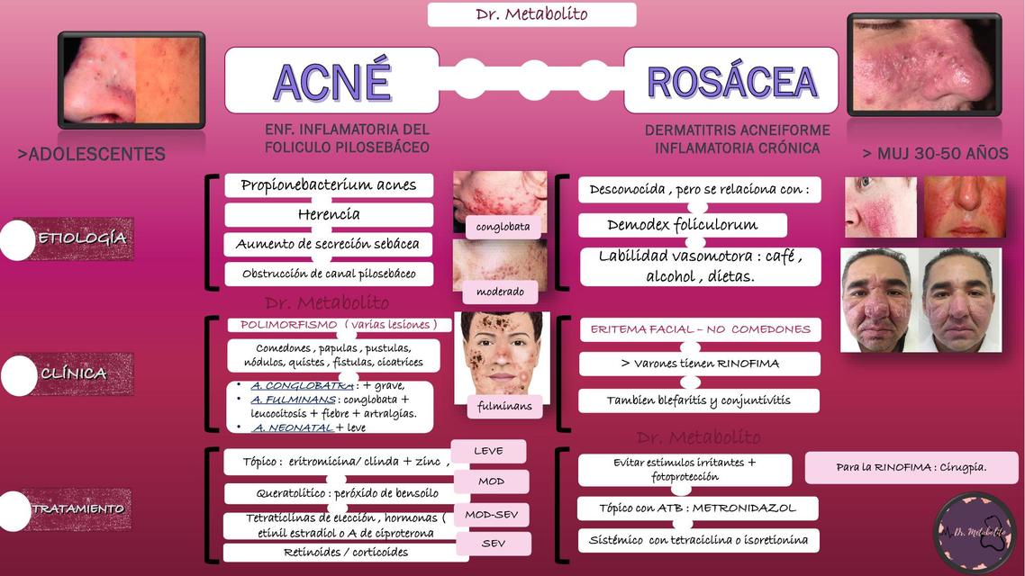 ACNÉ Y ROSÁCEA SÚPER FÁCIL