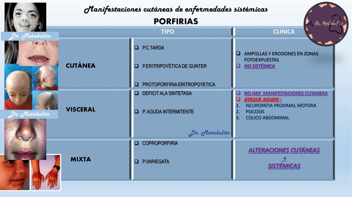 Porfirias Tips Claves Ghanddy Larrea Udocz