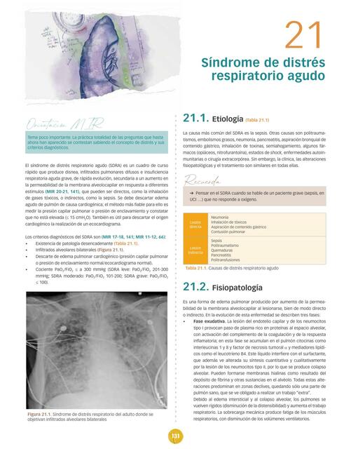 Síndrome de distrés respiratorio agudo | Full ciencia | uDocz