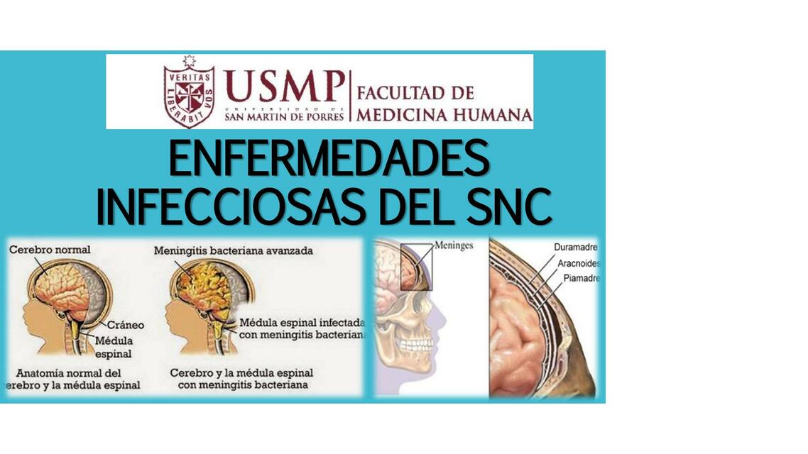 Enfermedades infecciosas del SNC | Tiroxina Med | uDocz