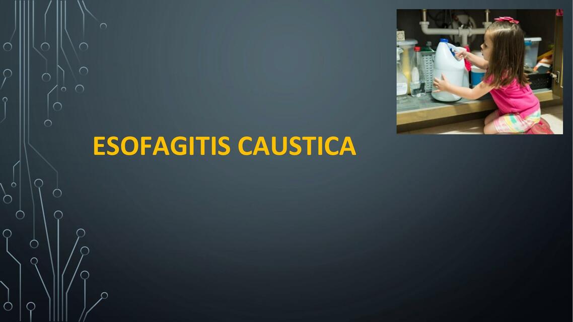 Esofagitis caústica | Tiroxina Med 🩺 | uDocz