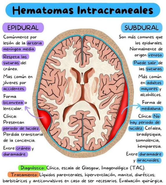 Hematomas Intracraneales | YUDOC.ORG | uDocz