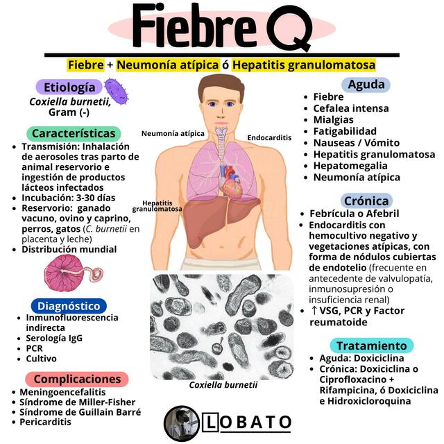 Fiebre Q 🩺| Clínica, Diagnóstico, Tratamiento, Complicaciones | Lobato ...