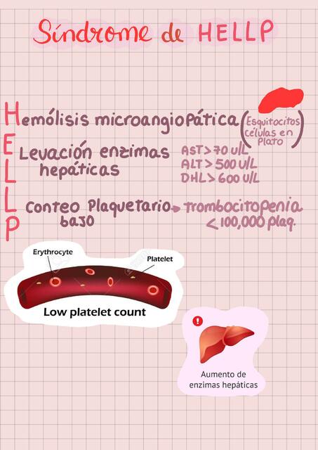 Sindrome de HELLP | Hilemny Luna | uDocz