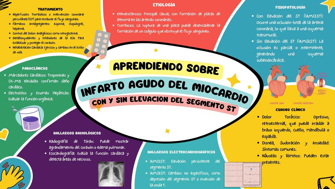 Infarto agudo del miocardio | Jessy González | uDocz
