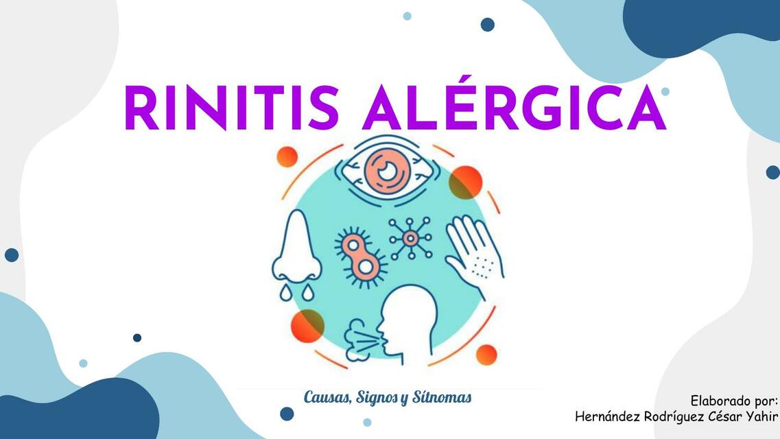 Rinitis alérgica | IOVANNY CRUZ OJEDA | uDocz