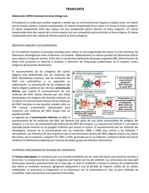 Trasplante | IOVANNY CRUZ OJEDA | uDocz