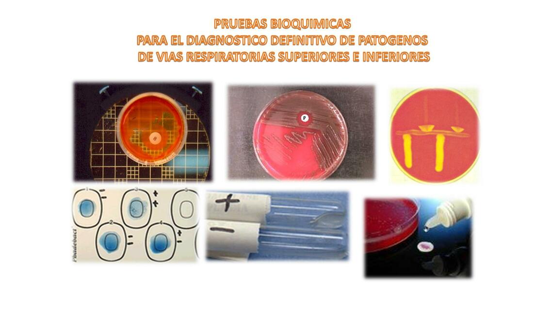 Resúmenes de Optoquina | Descarga apuntes de Optoquina
