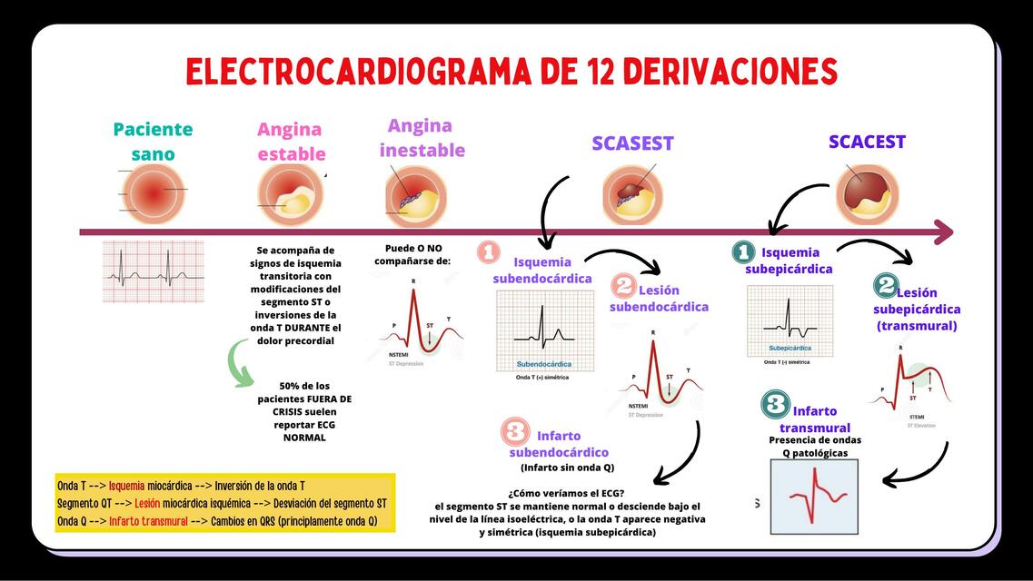 Cardiopatia isquemica ECG | Jessy González | uDocz