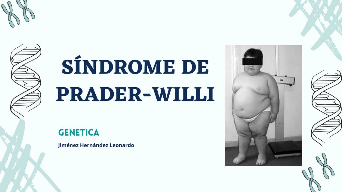 Sindrome de prader-willi | Jessy González | uDocz