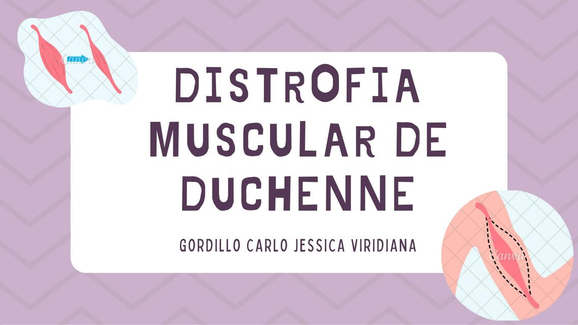 Distrofia muscular de Duchenne | Jessy González | uDocz